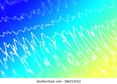 Eeg Wave Backgroundbackground Abnormal Eegbrain Wave Stock Photo ...