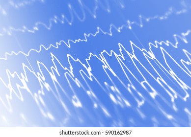Eeg Wave Backgroundbackground Abnormal Eegbrain Wave Stock Photo ...
