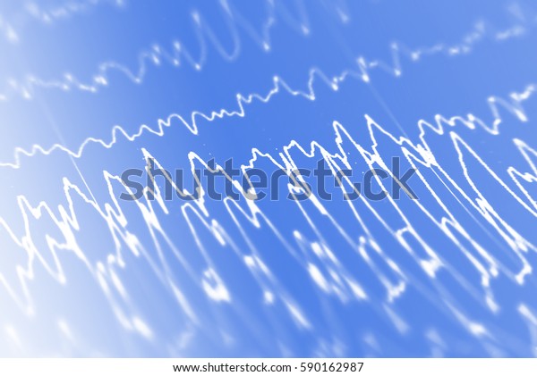 Eeg Wave Backgroundbackground Abnormal Eegbrain Wave Stock Photo ...