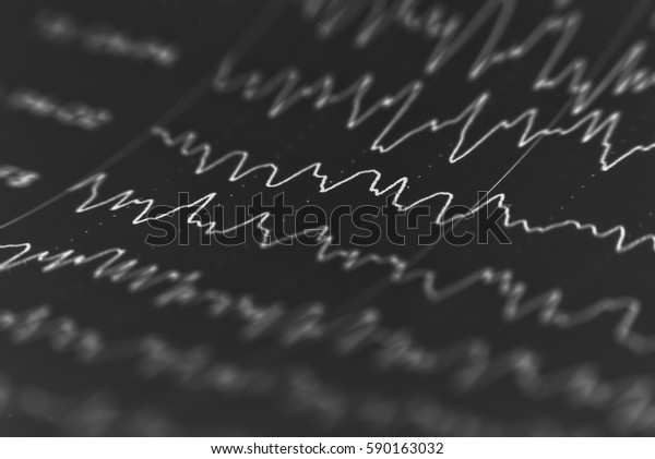 Eeg Wave Backgroundbackground Abnormal Eegbrain Wave Stock Photo (Edit ...