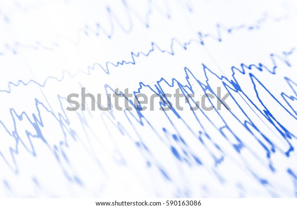 Eeg Wave Backgroundbackground Abnormal Eegbrain Wave Stock Photo (Edit ...