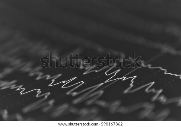 Eeg Wave Backgroundbackground Abnormal Eegbrain Wave Stock Photo ...
