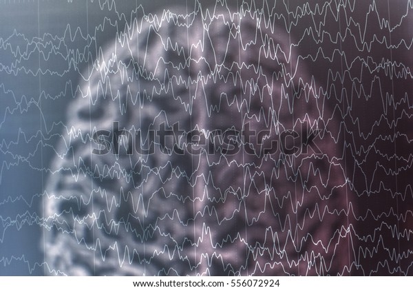 Eeg Wave Backgroundbrain Brain Wave Stock Photo (Edit Now) 556072924