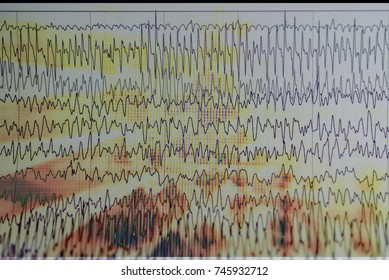 Eeg Wave Human Brain Brain Wave Stock Photo 745932712 | Shutterstock