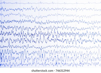 Abnormal Eeg Wave Formabnormal Eegbrain Wave库存照片1056833492 | Shutterstock