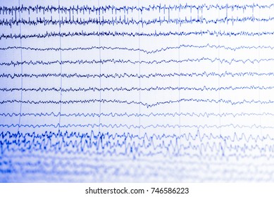 Eeg Wave Human Brain Brain Wave 스톡 사진 746586223 | Shutterstock