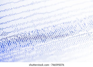 Abnormal Eeg Wave Formabnormal Eegbrain Wave Stock Photo (Edit Now ...