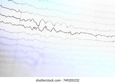 Abnormal Eeg Waveform Abnormal Eeg Brainwave Stock Photo (Edit Now ...