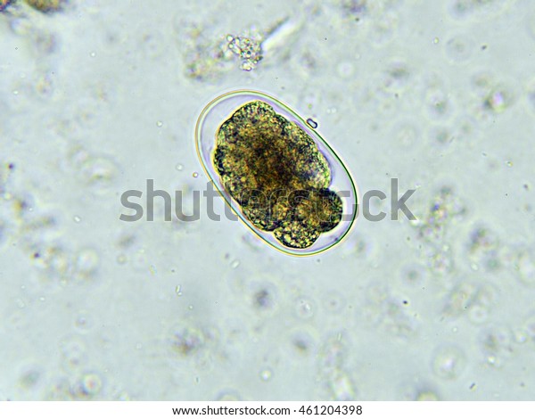 Egg Hookworm Stool Analyze By Microscope Stock Photo 461204398 ...