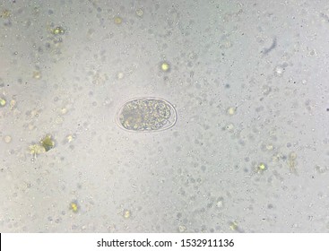 Egg Hookworm Under Microscope Science Laboratory Stock Photo 1532911136 ...