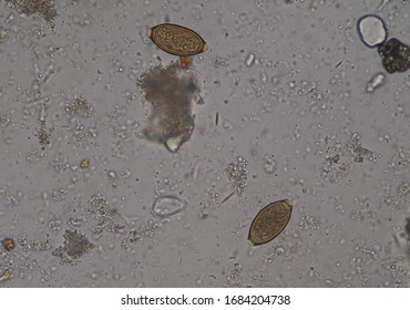 Enterobius Vermicularis Egg Parasite Stool Under Stock Photo (Edit Now ...