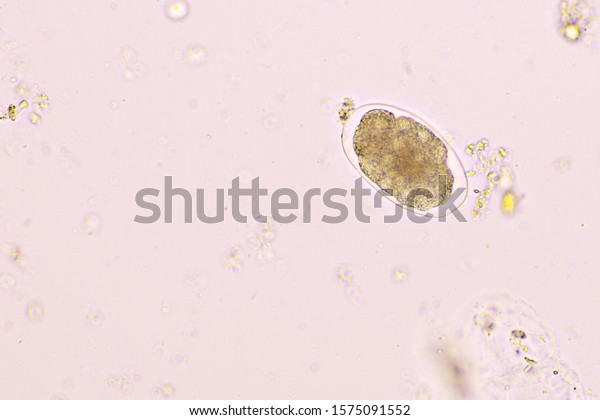 Eggs Hookworm Human Stool Analyze By Stock Photo (Edit Now) 1575091552