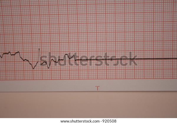 Ekg Flatline Stock Photo (Edit Now) 920508