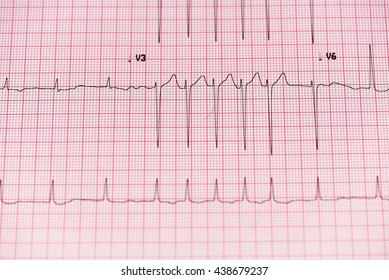 Ekg Graph Stock Photo 438679237 | Shutterstock