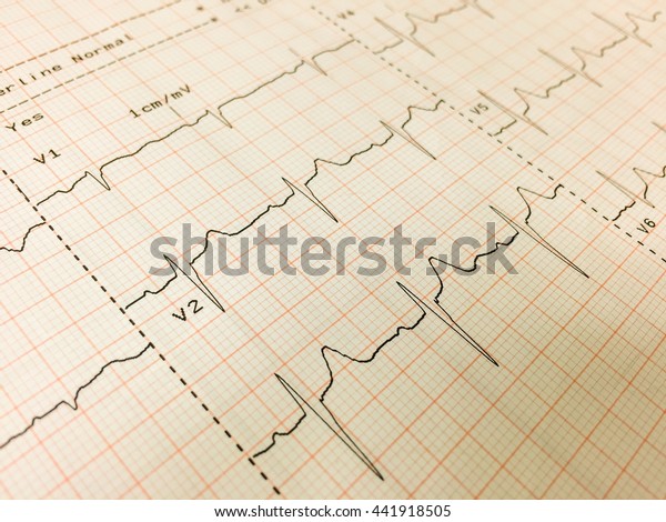 Ekg Graph Paper Background Pattern Selective Stock Photo 441918505 ...