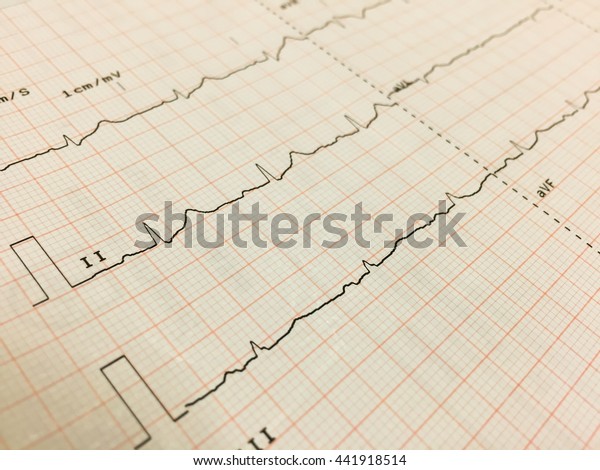 Ekg Graph Paper Background Pattern Selective Stock Photo 441918514 ...