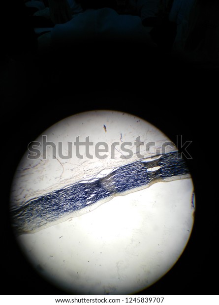 Elastic Artery On Microscope View Stock Photo 1245839707 | Shutterstock