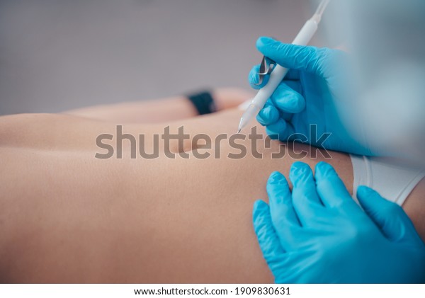 Electro Epilation Procedure Close Bikini Zone Stock Photo 1909830631 ...