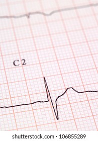 Electrocardiogram Graph Ekg Heart Rhythm Calipers Foto stock 1151676866 ...