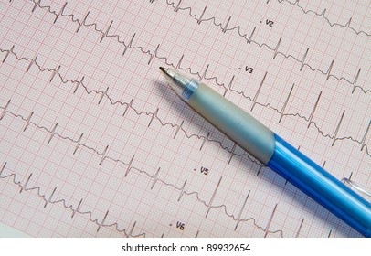 Pen Ecg Graph Electrocardiogram Ekg Background Foto Stok 283113758 ...