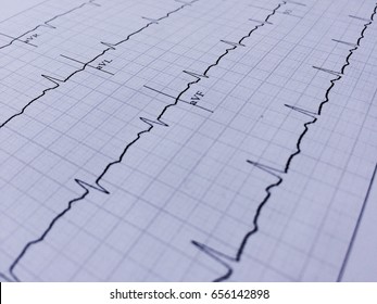 Electrocardiogram Record Paperheart Ekg Cardiogram Chart Stock Photo ...