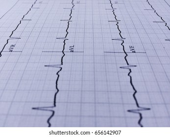 Electrocardiogram Record Paperheart Ekg Cardiogram Chart Stock Photo ...
