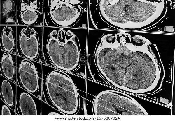 171 Mri Scan Human Eye Images, Stock Photos & Vectors | Shutterstock
