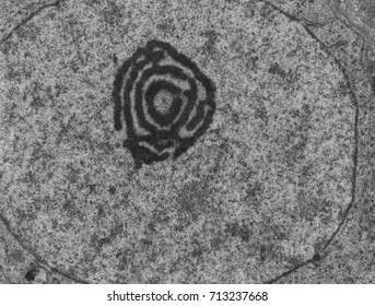 Electron Microscope Micrograph Showing Nucleolus Atypical Stock Photo ...