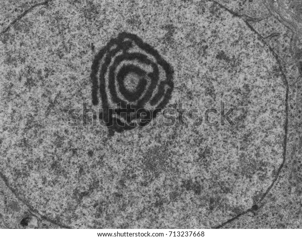 Electron Microscope Micrograph Showing Nucleolus Atypical Stock Photo ...