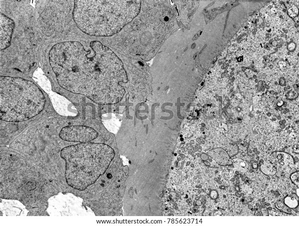 Electron Microscope Micrograph Showing Zona Pellucida Stock Photo (Edit ...