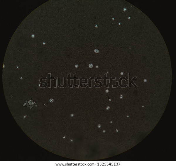 Encapsulated Yeast Budding Yeast Cells Cryptococcal Stock Photo ...