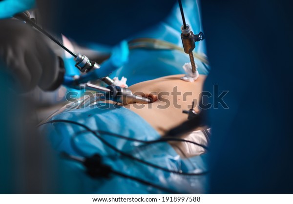 Endoscopic Surgery Remove Uterus Stock Photo 1918997588 | Shutterstock