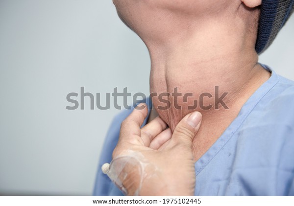 Enlarged Multinodular Thyroid Goiter Middleaged Asian Stock Photo ...