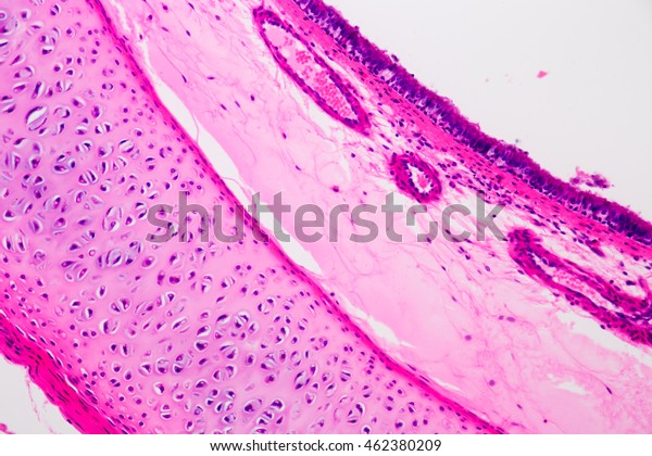 Epithelium Transitional Tissue Cross Section Under Stock Photo (Edit ...