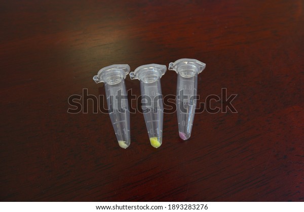 Eppendorf tubes of bacterial cell pellets under white light; E. coli ...