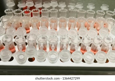 Eppendorf Tubes Samples Fluid Analysis Laboratory Stock Photo ...