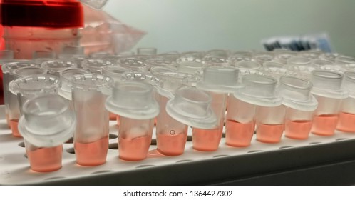 Eppendorf Tubes Samples Fluid Analysis Laboratory Stock Photo ...