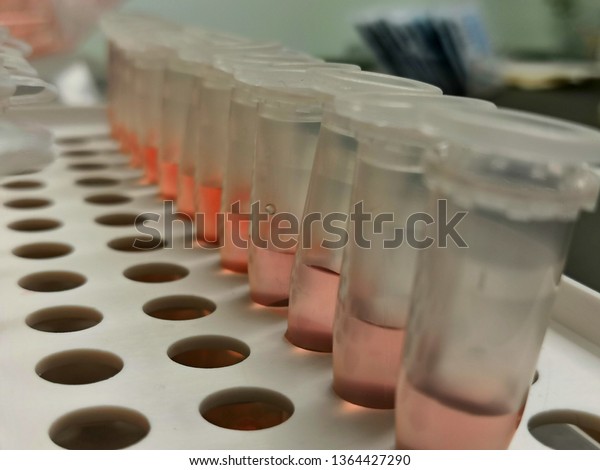 Eppendorf Tubes Samples Fluid Analysis Laboratory Stock Photo ...