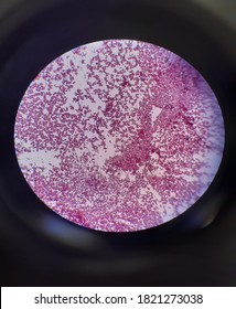 Autoagglutination Red Blood Cell Light Microscope Stock Photo (Edit Now ...
