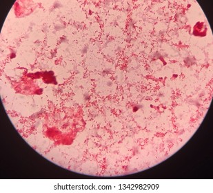 Expansion Pathogen Looking Through Microscope Virus Stock Photo ...