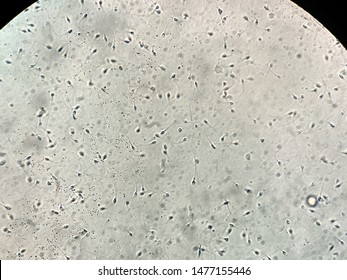 Crenated Red Blood Cell Normal Red库存照片601107191 | Shutterstock