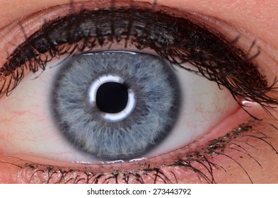 Close Severe Proptosis Chemosis During Eye Stock Photo (Edit Now) 472884928