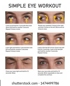 Ptosis pediátrica. Ojo de un niño Foto de stock 1402153445 | Shutterstock