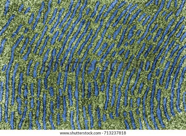 False Colour Tem Micrograph Proteinsynthetizing Cell Stock Photo (Edit ...