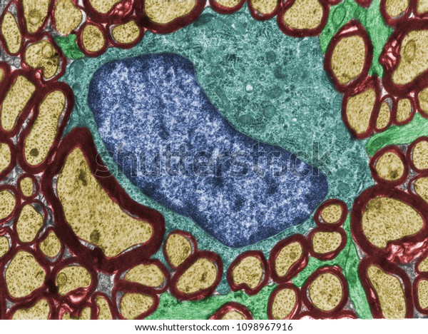 False Colour Transmission Electron Microscope Tem库存照片1098967916 ...