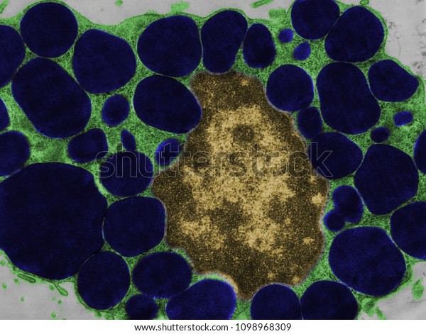 False Colour Transmission Electron Microscope Tem Stock Photo (Edit Now ...