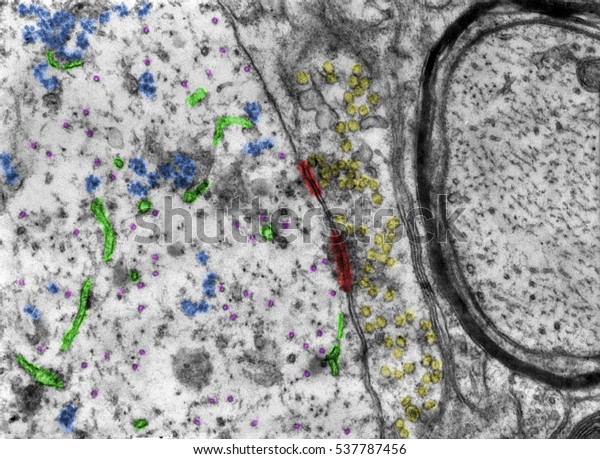 False Colour Transmission Electron Microscope Tem Foto de stock ...