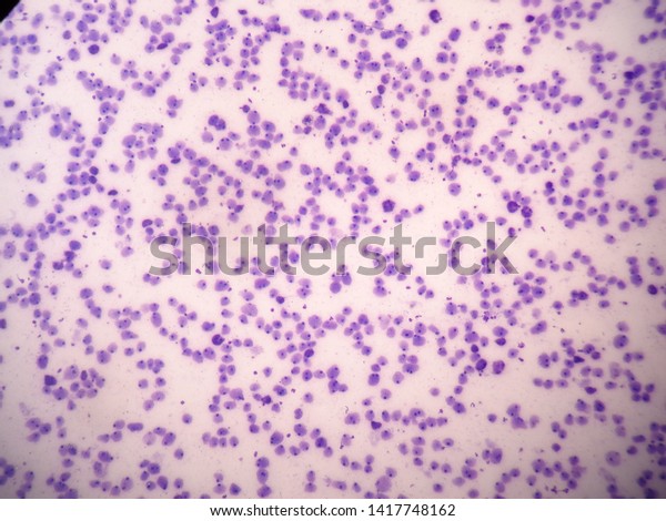 Feline Blood Sample Under Microscope View Stock Photo 1417748162 ...