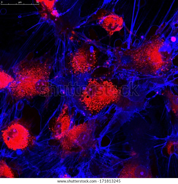 Fibroblasts (skin cells) labeled with fluorescent dyes. Mitochondrias ... Fibroblasts (skin cells) labeled with fluorescent dyes. Mitochondrias ...