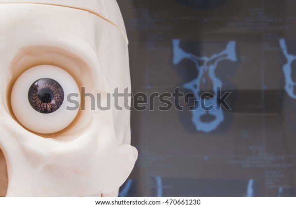 Figure Human Skull Eye Socket Eye Stock Photo 470661230 | Shutterstock